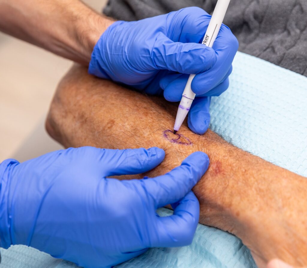 Surgical Dermatologist in McKinney